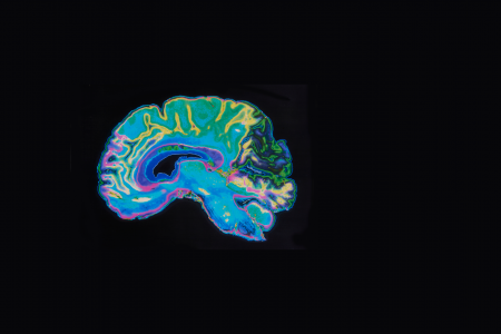 Les mécanismes de l’addiction révélés | Pulsations